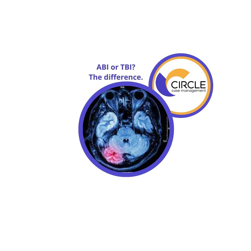 Acquired brain injury and traumatic brain injury - what is the difference? | Circle Case Management